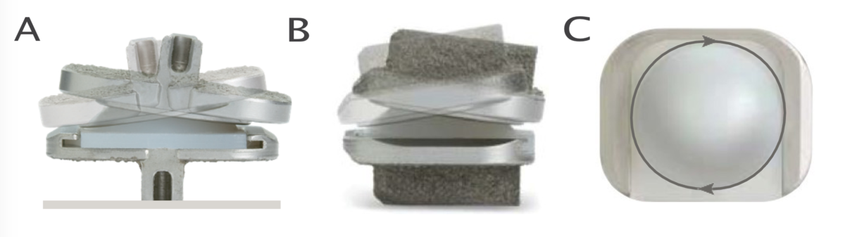 prodisc C Total Disc Replacement - San Antonio, TX - Spine Doctor